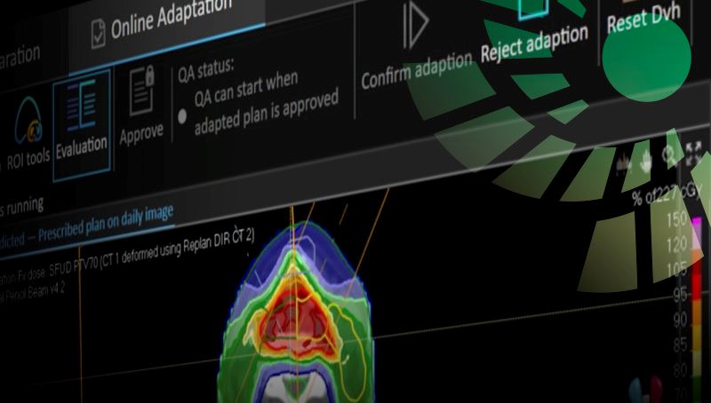 新一代肿瘤信息系统– RayCare | RaySearch Laboratories China