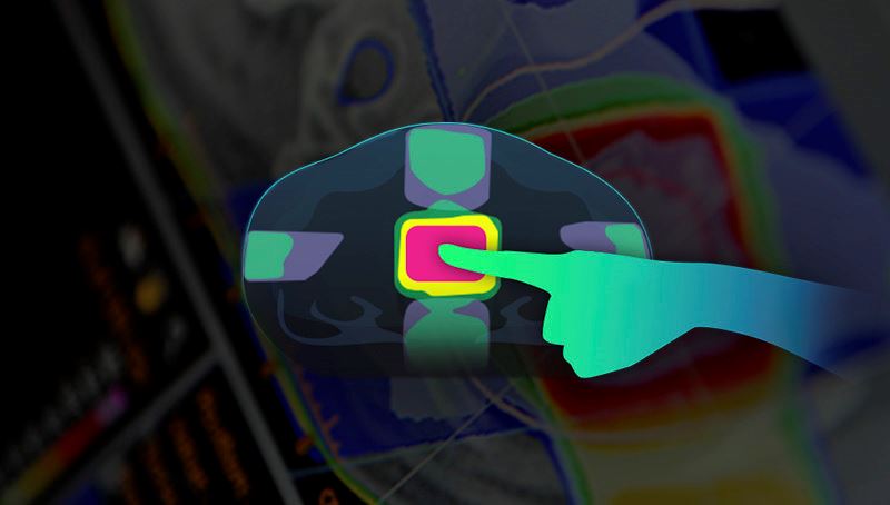 治疗计划系统 – RayStation | RaySearch Laboratories China