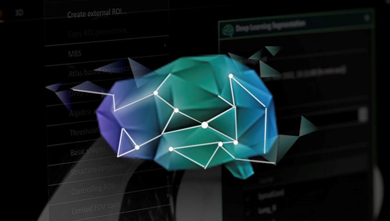 治疗计划系统 – RayStation | RaySearch Laboratories China