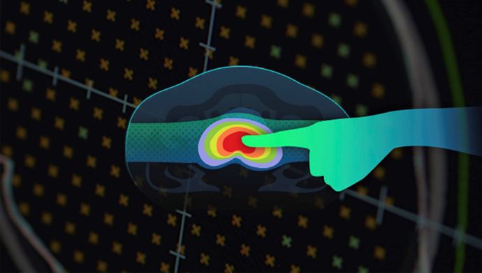 治疗计划系统 – RayStation | RaySearch Laboratories China