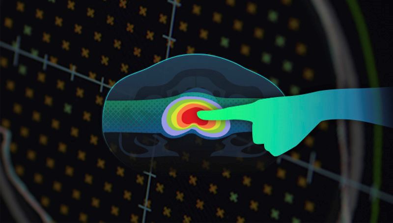 治疗计划系统 – RayStation | RaySearch Laboratories China