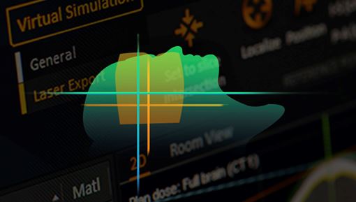治疗计划系统 – RayStation | RaySearch Laboratories China