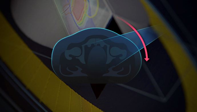 治疗计划系统 – RayStation | RaySearch Laboratories China