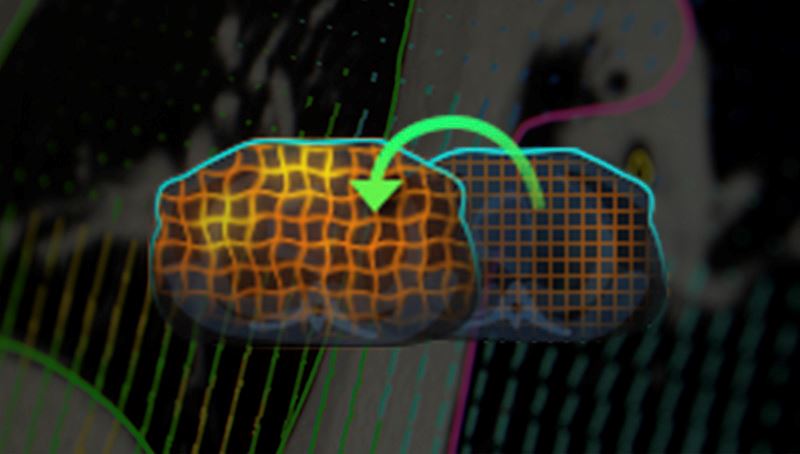 治疗计划系统 – RayStation | RaySearch Laboratories China